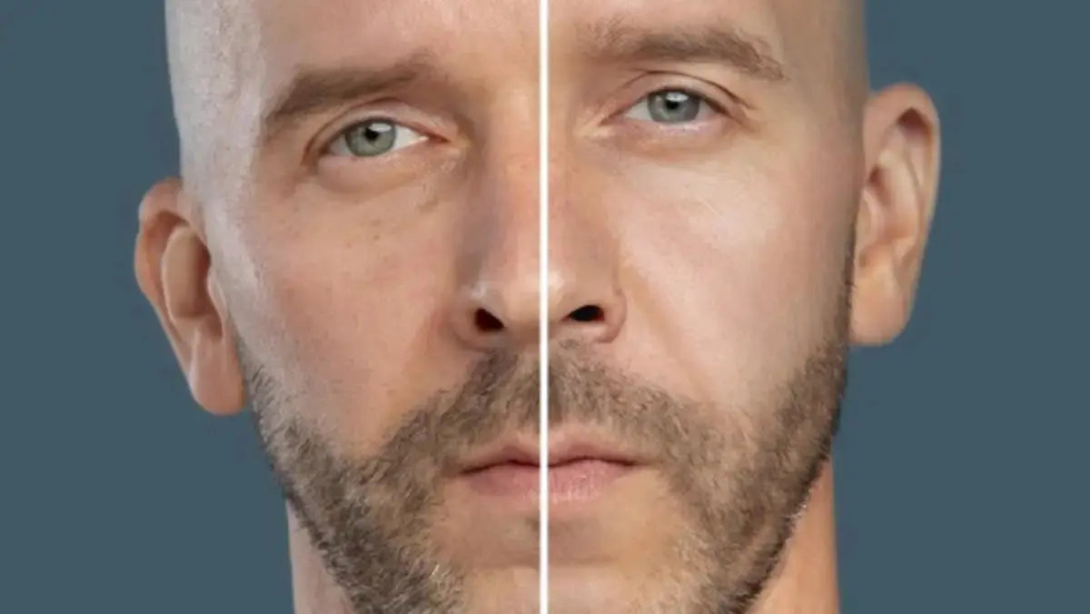 mandibular breathing